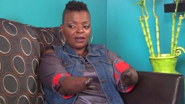 Kylie Jenner Jealous Of Kendall, Planning $85,000 Worth Of Plastic ...