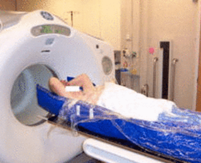 Stereotactic Body Radiation Therapy (SBRT) | AARO Singapore