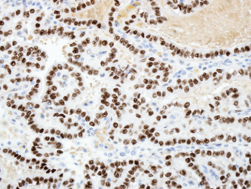 C2-FF48.gif | Abdominal Key