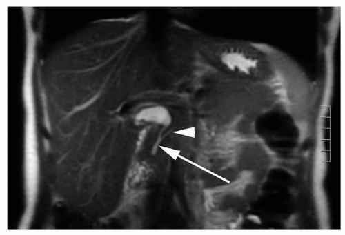 C29-FF2.gif | Abdominal Key