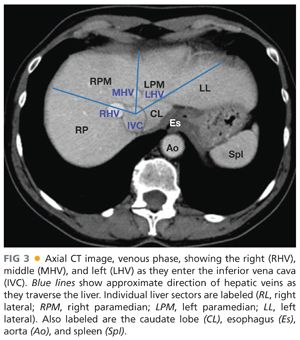 image00800.jpeg | Abdominal Key