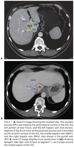 image00802.jpeg | Abdominal Key