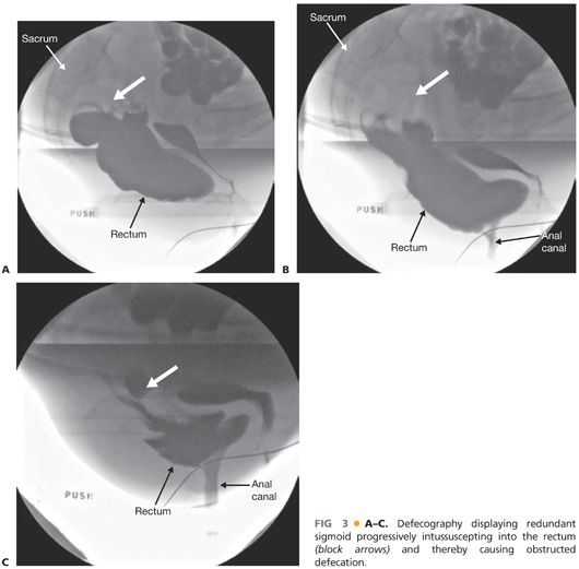 image00847.jpeg | Abdominal Key