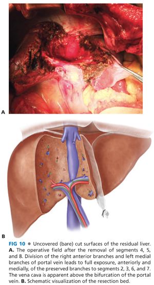 image00974.jpeg | Abdominal Key