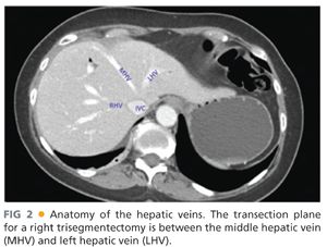 image00994.jpeg | Abdominal Key