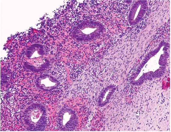image00355.jpeg | Abdominal Key