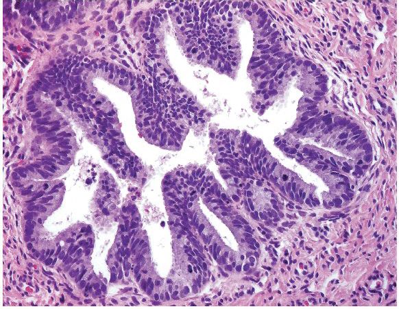 image00376.jpeg | Abdominal Key