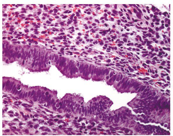 image00407.jpeg | Abdominal Key