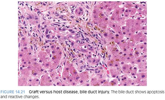 image00641.jpeg | Abdominal Key