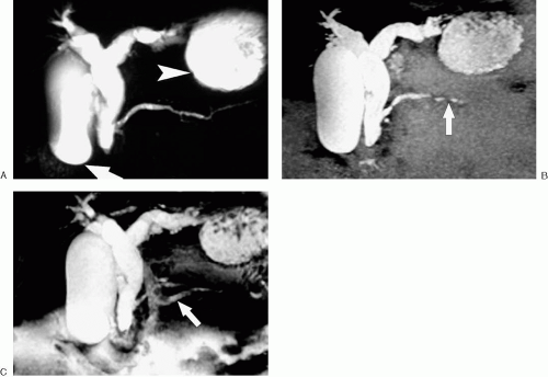 C2-2-FF1.gif | Abdominal Key
