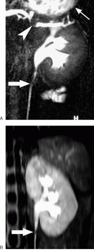 C2-3-FF2.gif | Abdominal Key