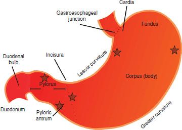 image00793.jpeg | Abdominal Key