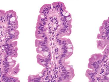 SMALL BOWEL | Abdominal Key
