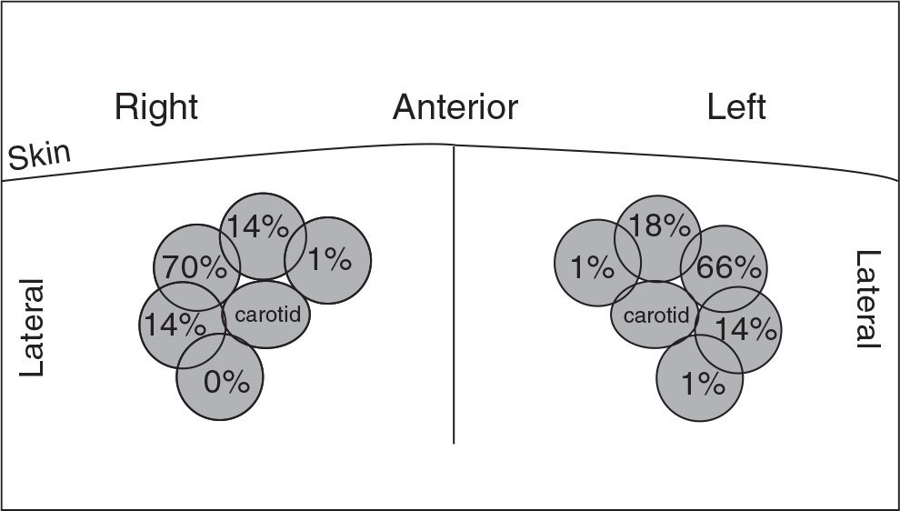 Venous Catheter Access: The Basics | Abdominal Key