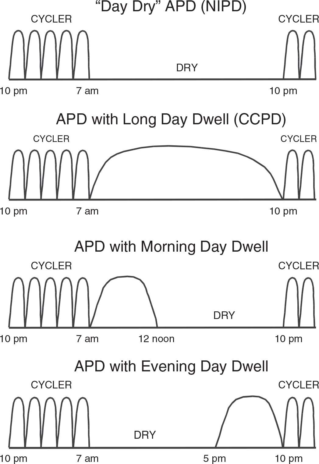 Apparatus for Peritoneal Dialysis | Abdominal Key
