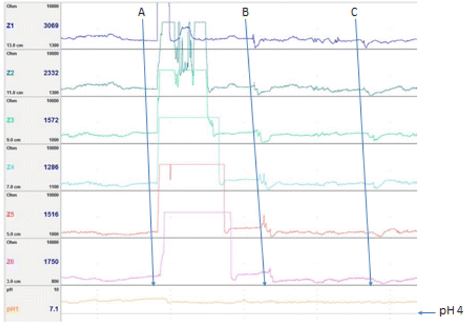 Aerophagia | Abdominal Key