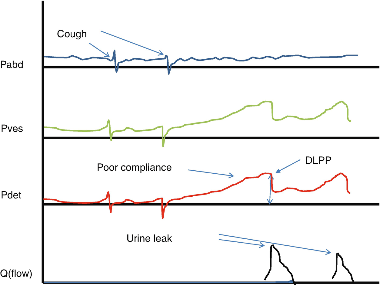 Bladder | Abdominal Key