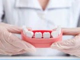 Gapped Teeth Veneers And Cosmetic Dentistry Solutions
