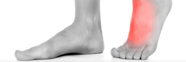 Pain on Top of the foot - Causes and Treatments for Top of Foot Hurts