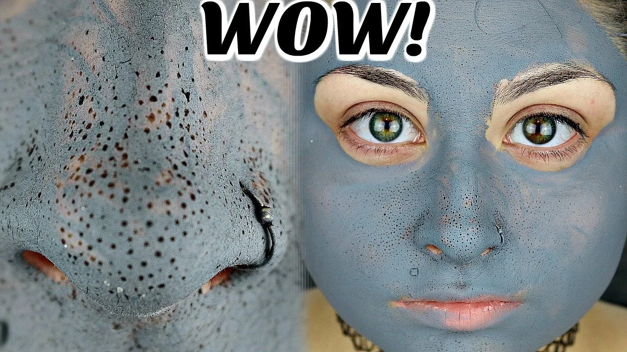 11 Simple Ways to Get Rid of Blackheads