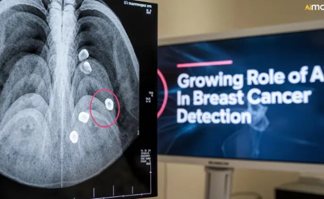 AI Breakthroughs In Detecting Breast Cancer: Key Innovations