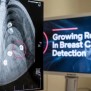AI Breakthroughs In Detecting Breast Cancer: Key Innovations