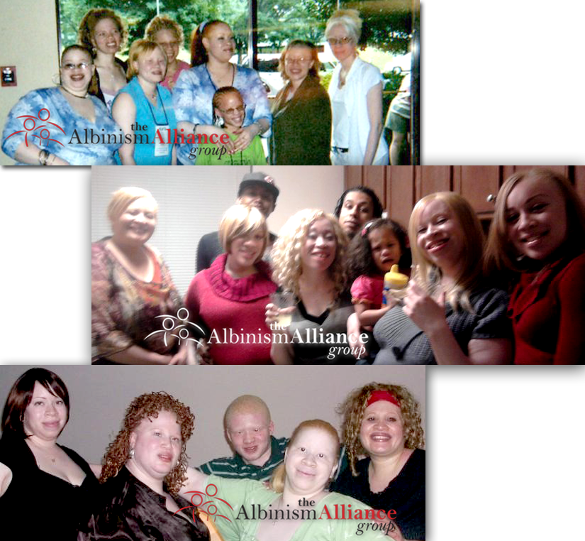 The Organization | The Albinism Alliance Group