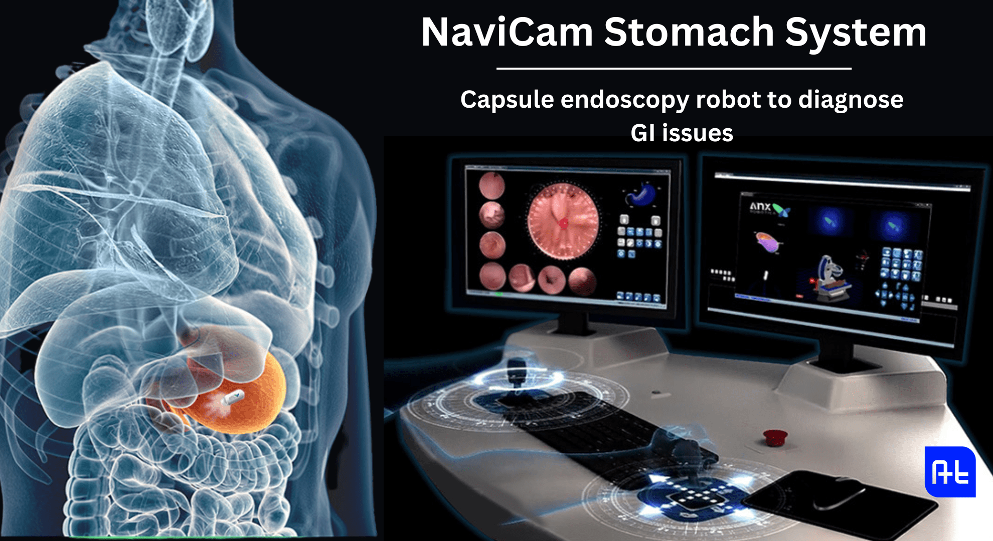 Endoscopy Capsule Radiology