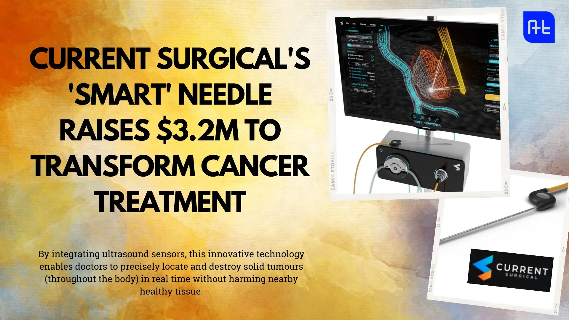 Current Surgical's 'Smart' Needle Raises $3.2M to Transform Cancer ...