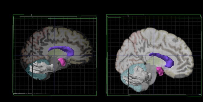 5 Places To Find Datasets For Powerful Neuroscience Research ...