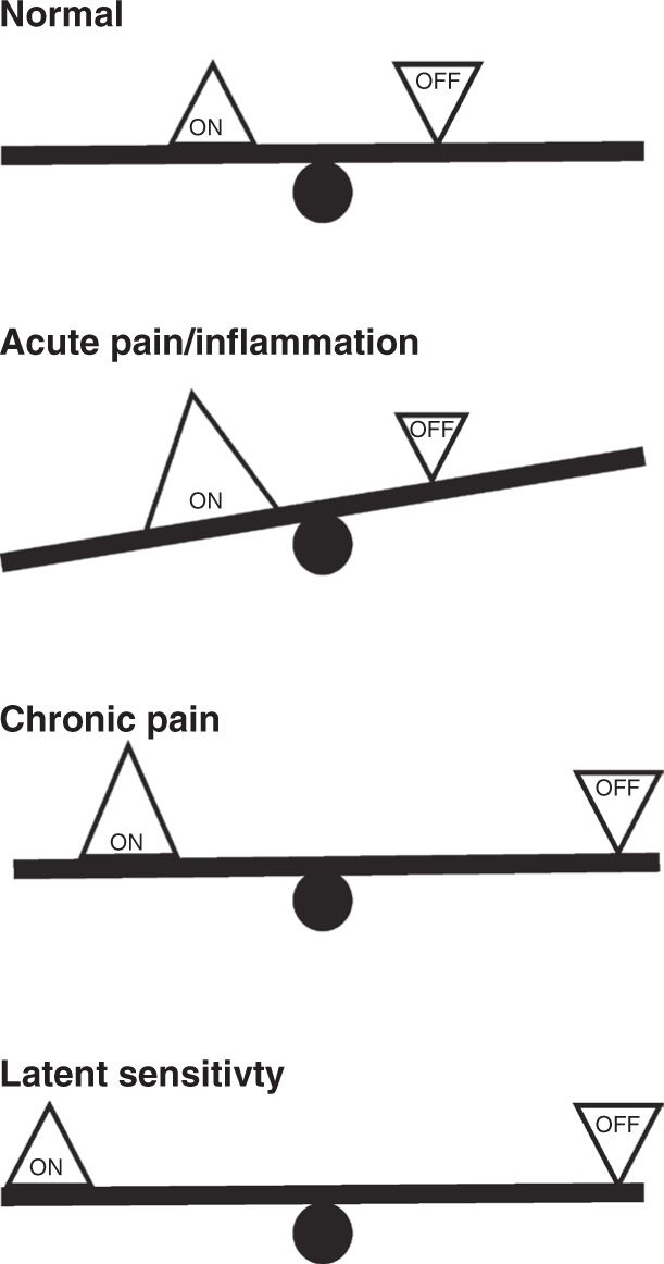 Descending Control Mechanisms and Persistent Pain after Surgery ...