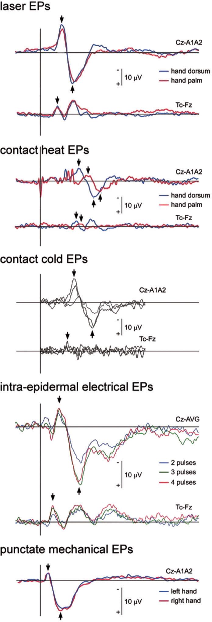 Electrophysiological Techniques to Study the Supraspinal Responses to ...