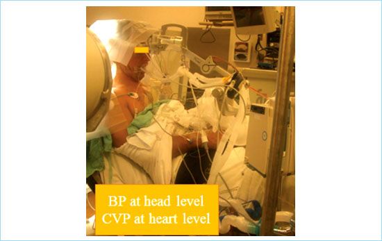 Sitting Position During Surgery | Anesthesia Key