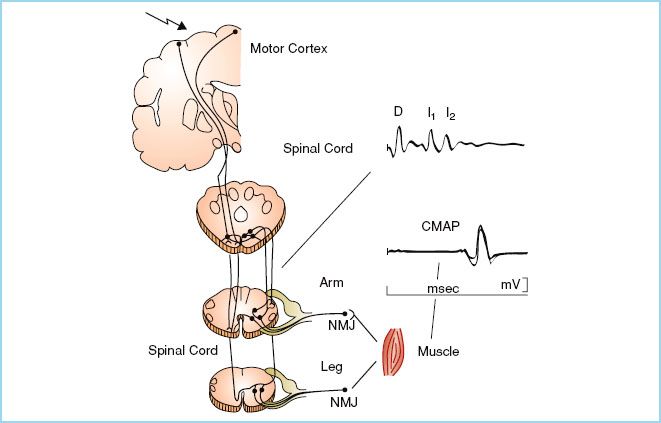 Electrophysiologic Monitoring (EEG and Evoked Potentials) | Anesthesia Key