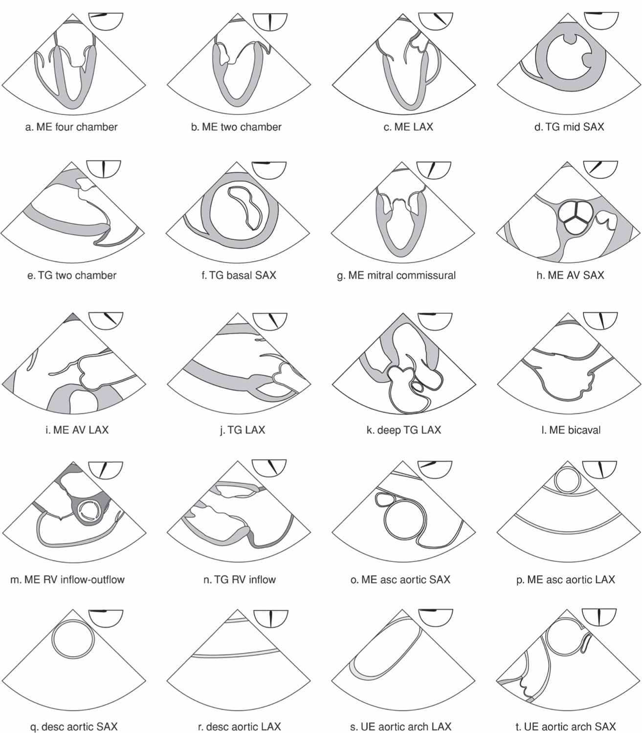 Cardiovascular Anesthesia | Anesthesia Key