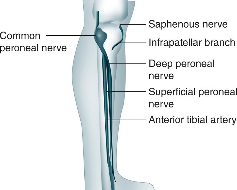 Peripheral Nerve Injury Associated With Labor | Anesthesia Key