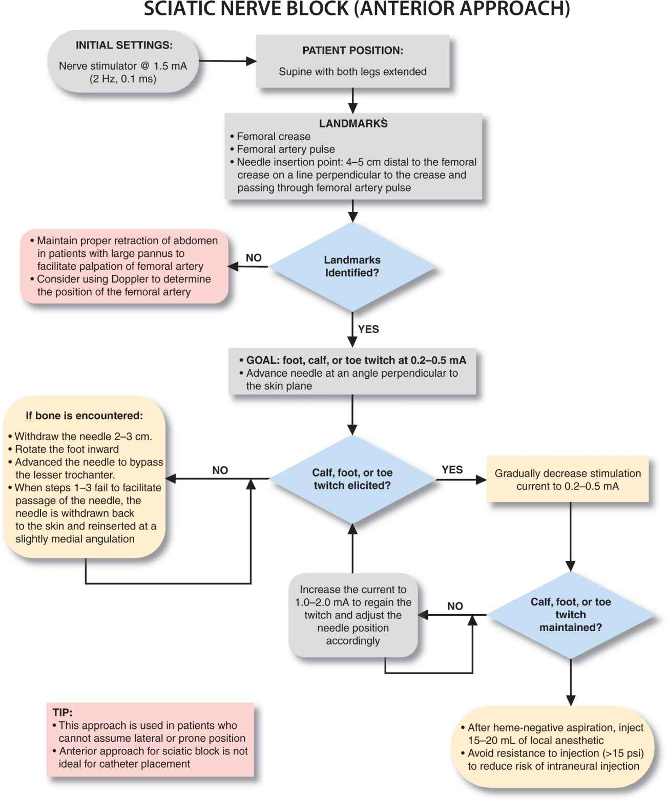 Sciatic Block | Anesthesia Key
