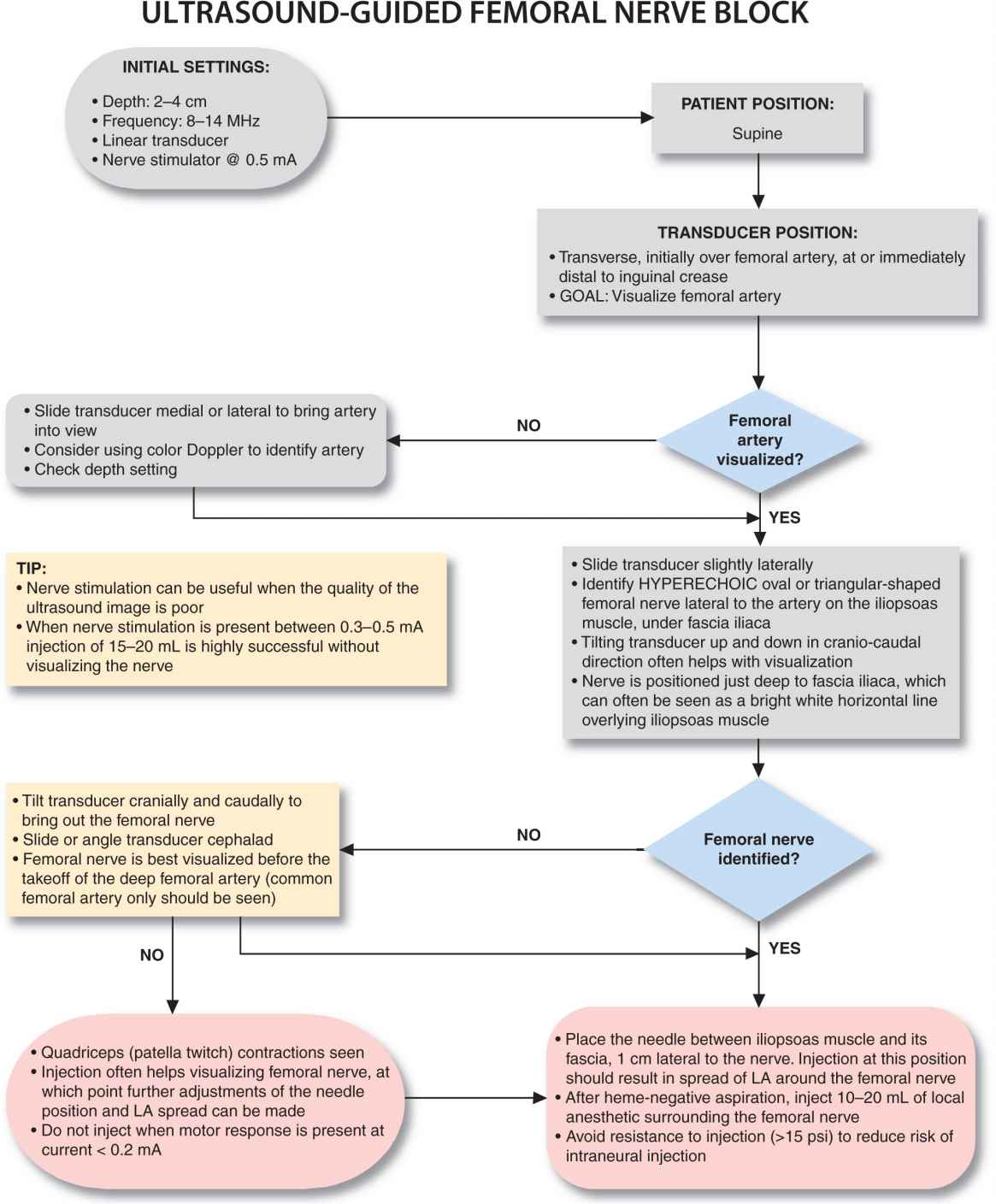 Ultrasound-Guided Femoral Nerve Block | Anesthesia Key