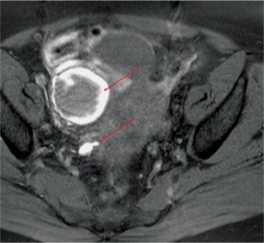 Magnetic Resonance Imaging: Basics | Anesthesia Key