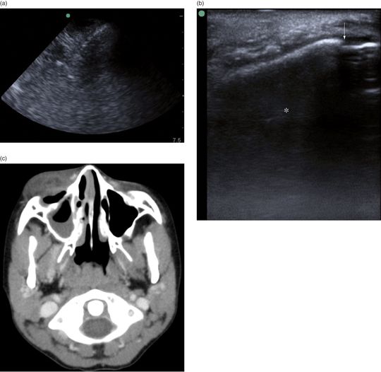 HEENT (head, ears, eyes, nose, throat): ocular, sinus, neck ultrasound ...