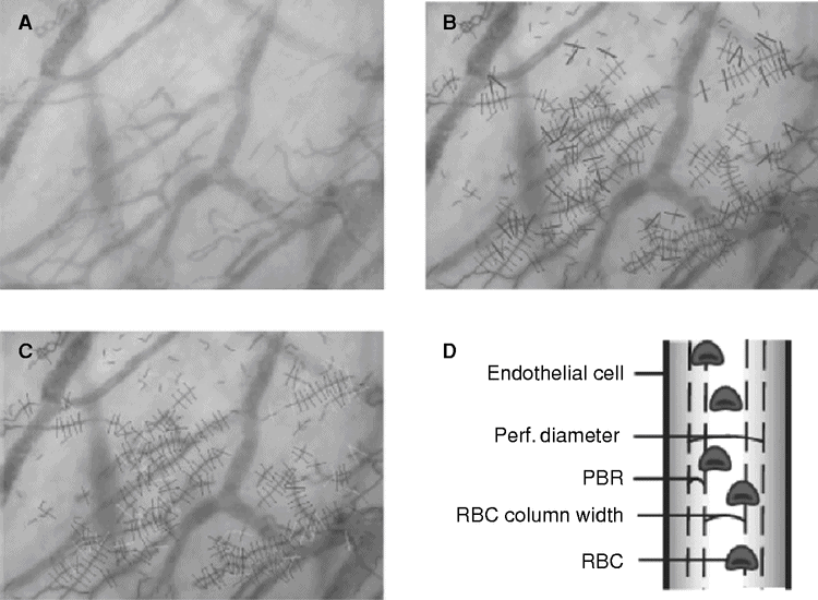 The glycocalyx layer | Anesthesia Key