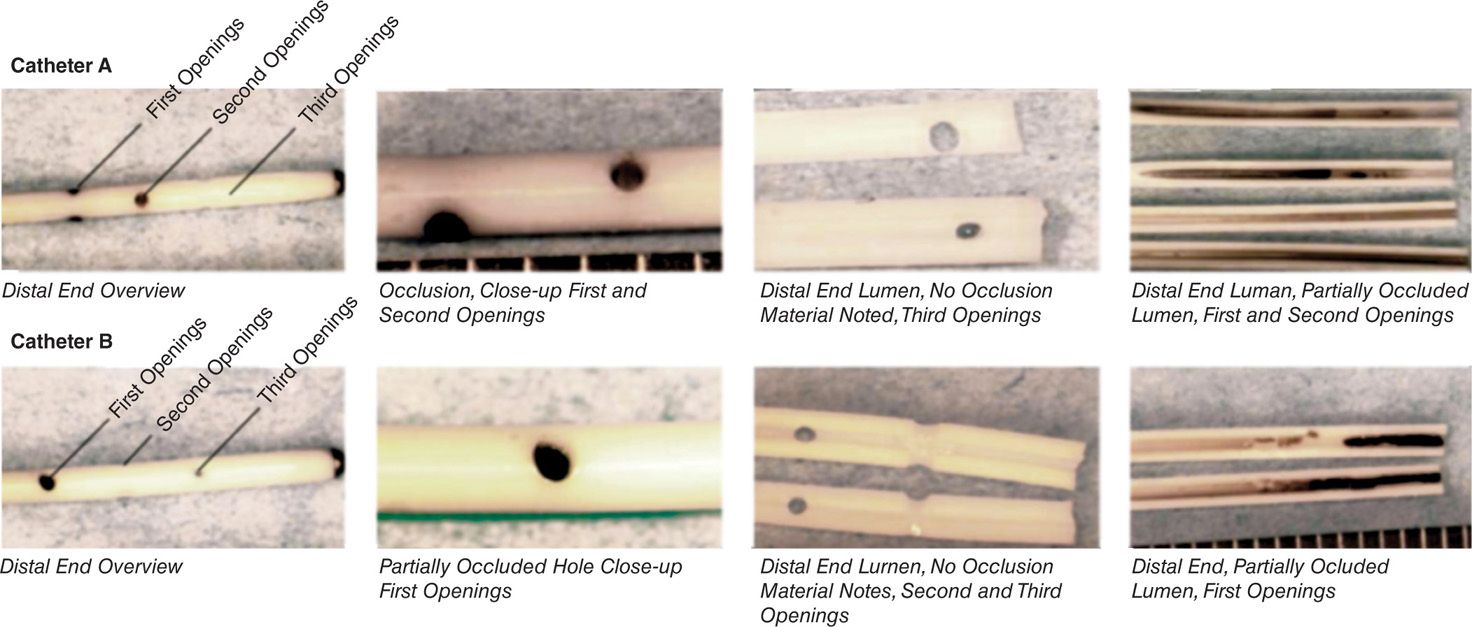 Choosing Intrathecal Medication | Anesthesia Key