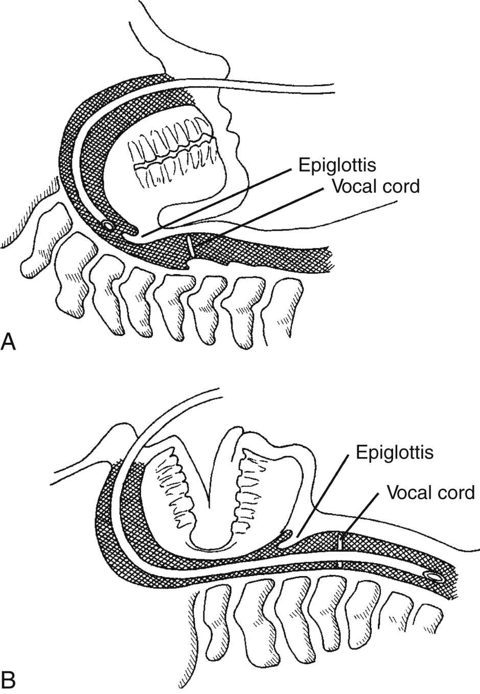 Patient Education and Care of the Perianesthesia Patient | Anesthesia Key