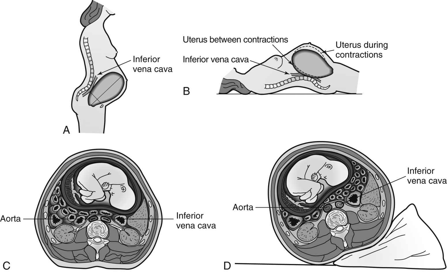 Care of the Shock Trauma Patient | Anesthesia Key