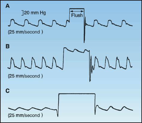 7 | Anesthesia Key