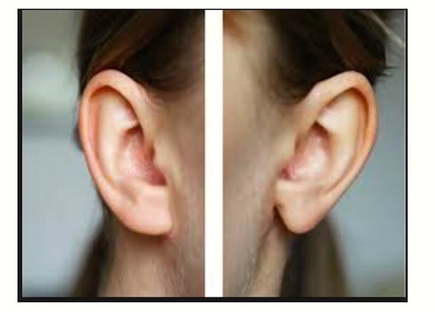 Revisiting 35: the protuberant acromion | Arnold Zwicky's Blog