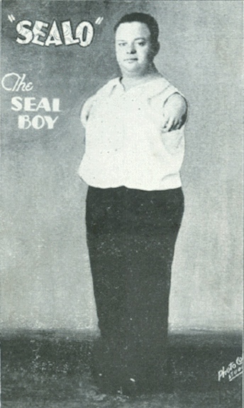 freak shows | Arnold Zwicky's Blog