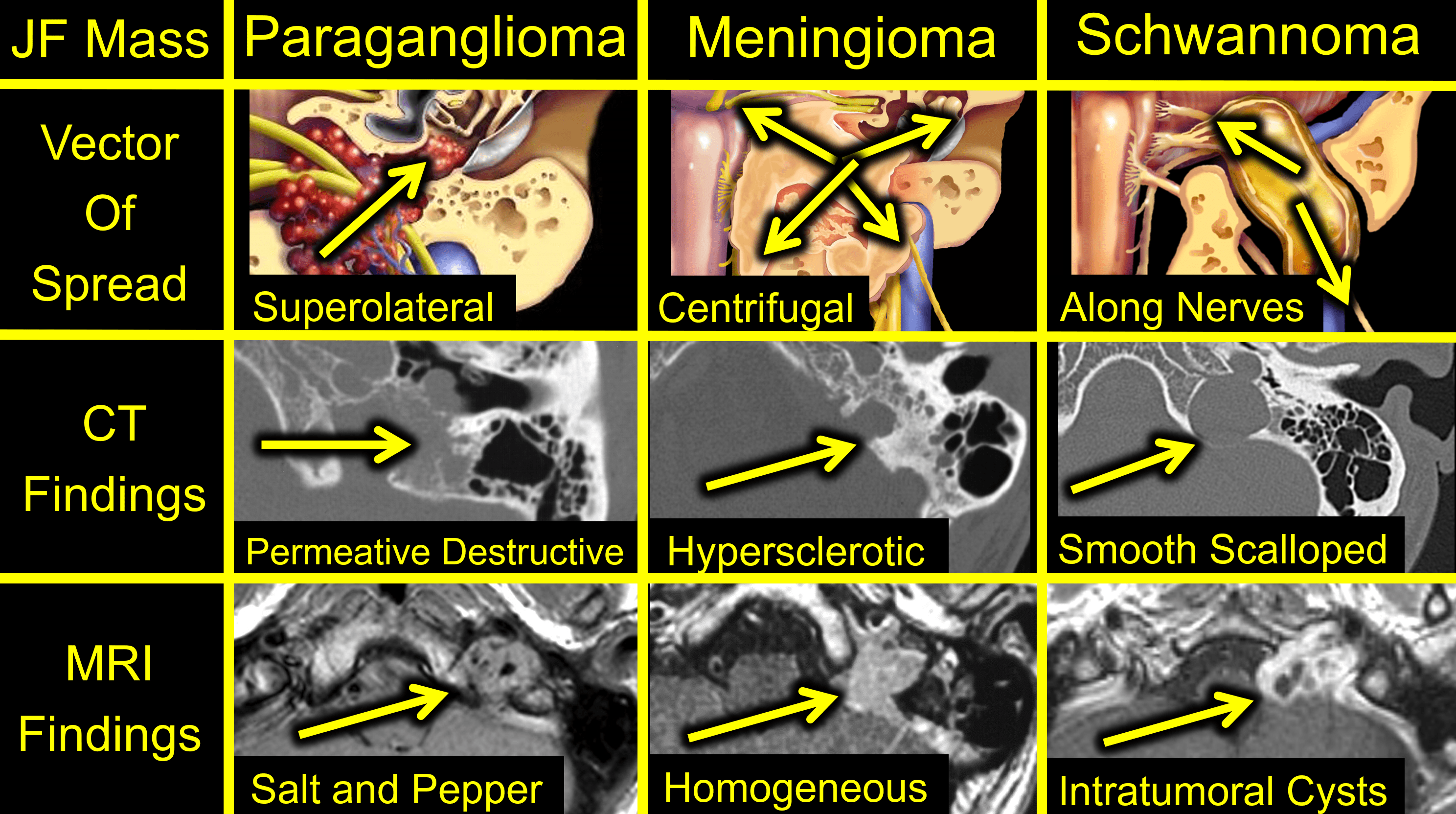 Everything You’ve Wanted to Know About Temporal Bone Imaging (But Were ...