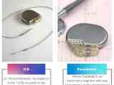 Icd Vs Pacemaker Difference And Comparison