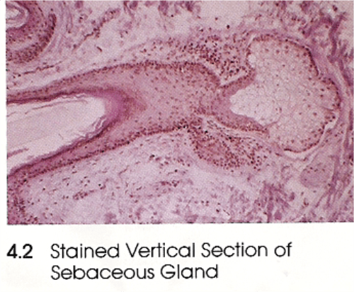 Sebaceous Gland - AskMags.com